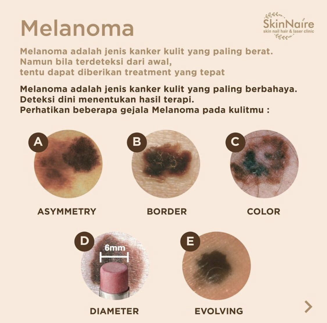 KANKER KULIT PADA ORANG ASIA DAN PENCEGAHANNYA – Skinnaire